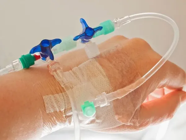 Human hand on IV drip in a hospital Our beautiful Wall Art and Photo ...